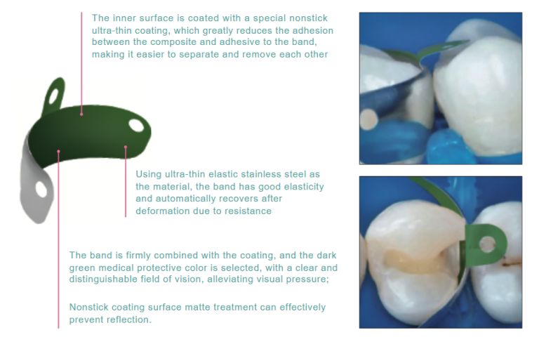 Sectional Matrix Bands V3 (50pcs/box) – Origin Dental